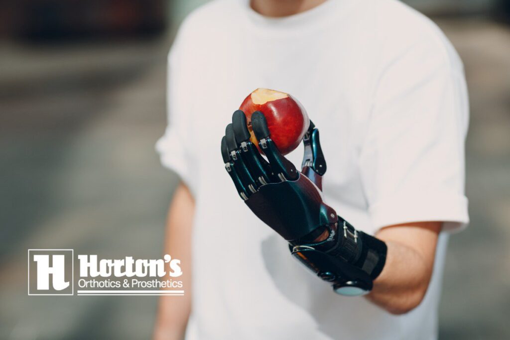 Where to buy prosthetics guide